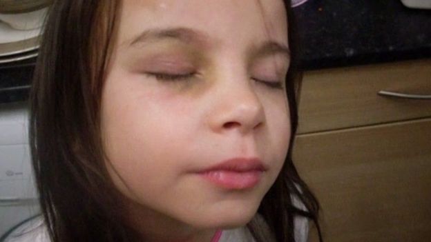 Pai Recupera Guarda Da Filha Na Justi a Para Mat la Com Golpes Na Cabe a Pai Recupera Guarda Da Filha Na Justi a Para Mat la Com Golpes Na Cabe a